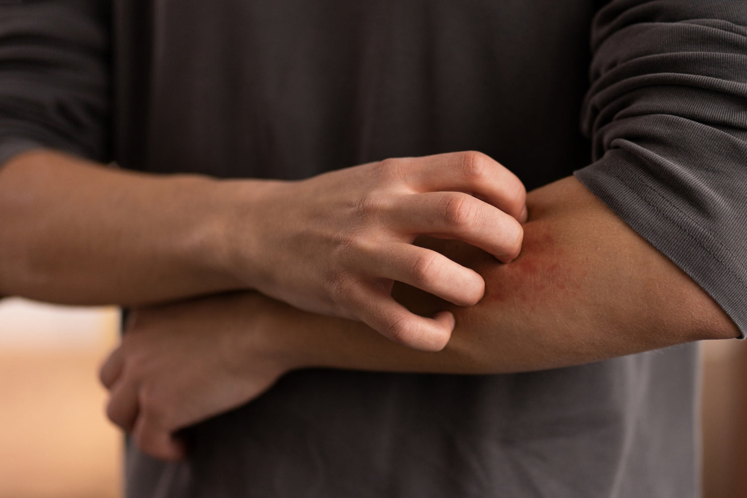 Do Bumble Bees Sting or Bite? Discover the Facts Here!